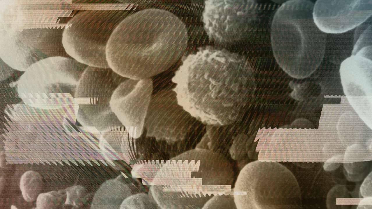 Why noise may be the key to understanding cell group patterns | Santa ...